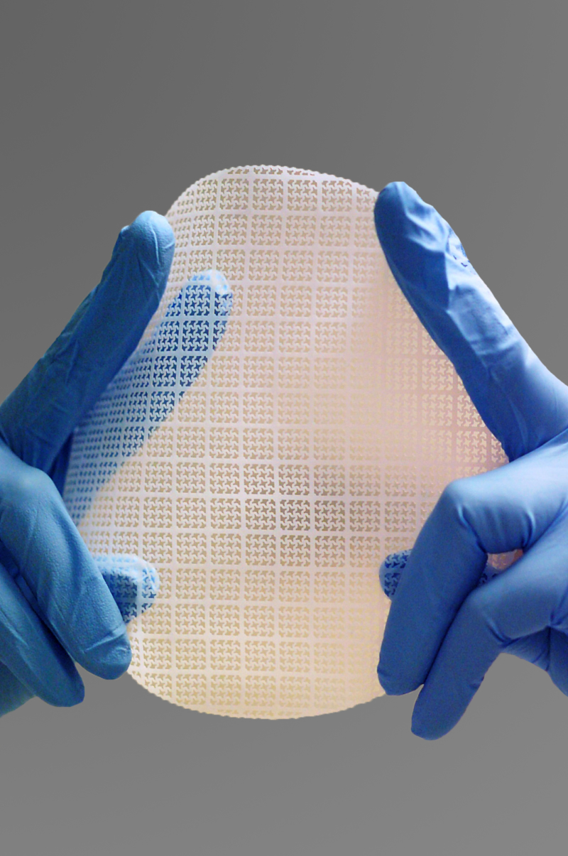 Proxy Biomedical MotifMESH - Aran Biomedical