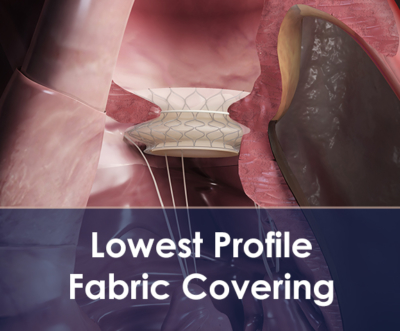 Aran Biomedical Pioneers Breakthrough Medical Textiles Valve Covering ...
