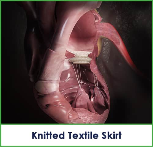 Knitted Implantable Textile Skirt - Aran Biomedical